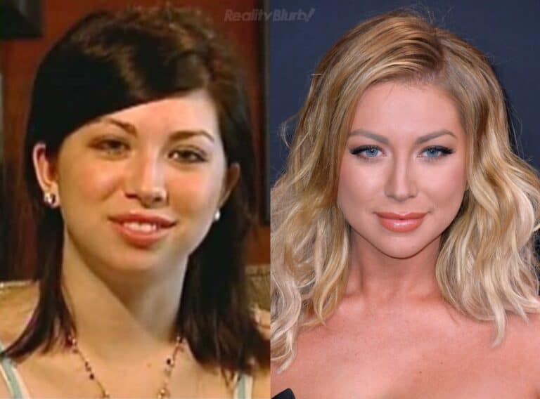 PHOTOS: See Vanderpump Rules' Stassi Before Her Chin Implant, She ...