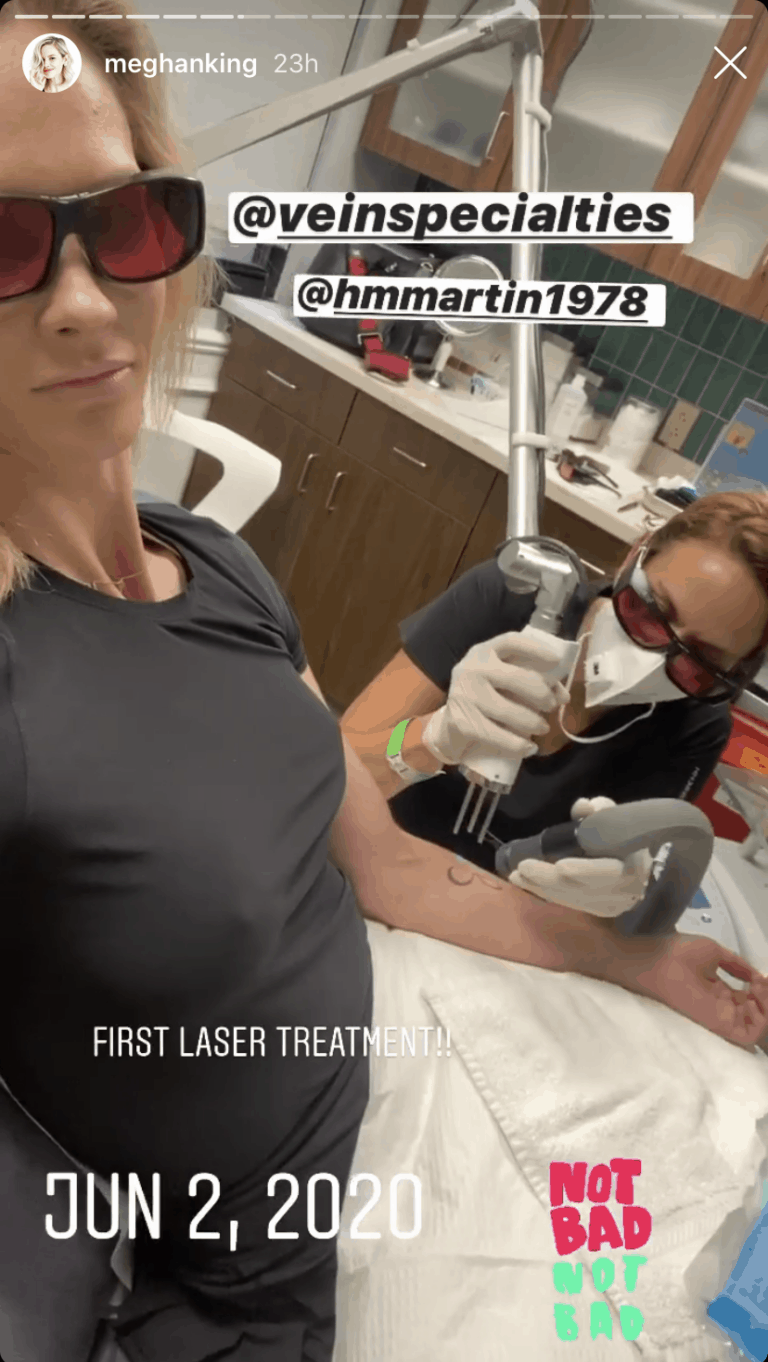 PHOTOS: Meghan King Removes Tattoo of Ex Jim Edmonds After Messy Split ...