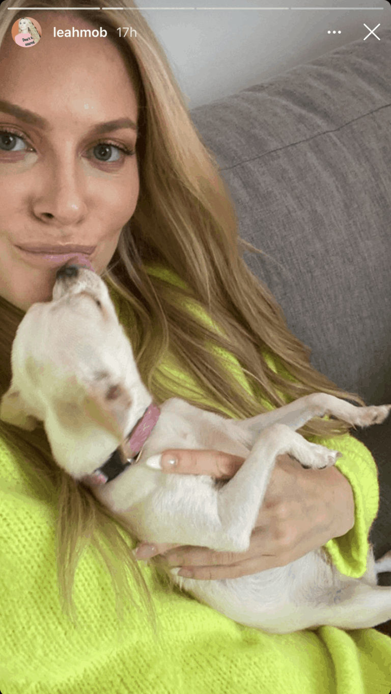 See Before and After Pics of Leah McSweeney's Nose Job After RHONY Star ...