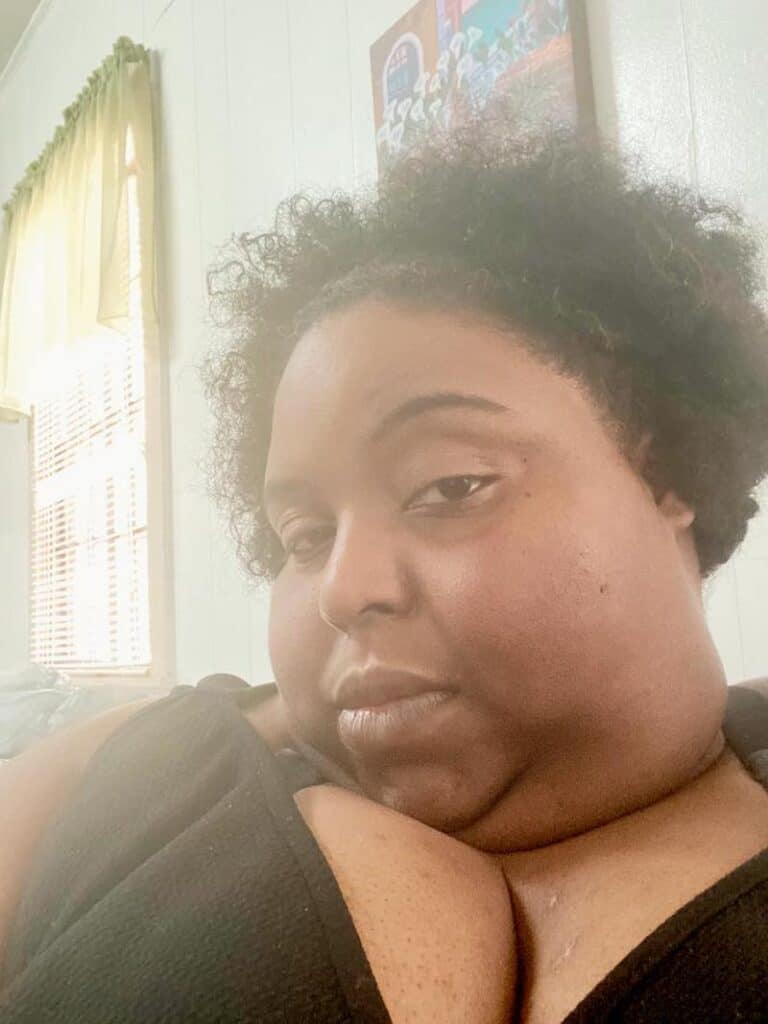 PHOTOS: See My 600-Lb Life Kenae Weight Loss Update