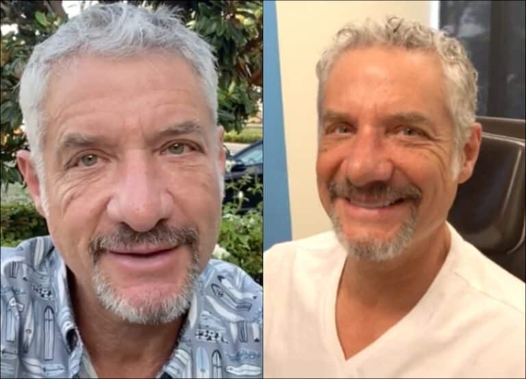 PHOTOS: Kelly Dodd’s Husband Rick Leventhal Gets Nose Job