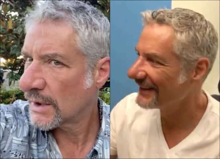 PHOTOS: Kelly Dodd’s Husband Rick Leventhal Gets Nose Job