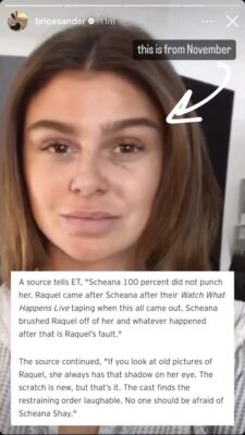 PHOTOS of Raquel Leviss With 'Black Eye' in November Surface