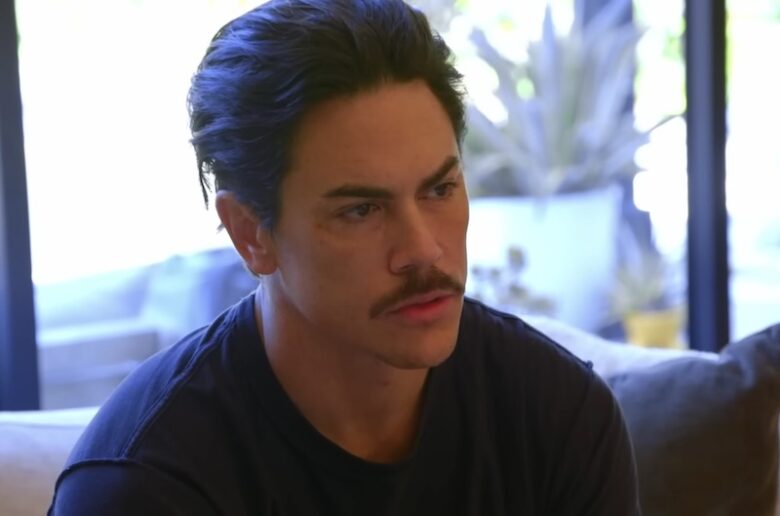 See Tom Sandoval's 'Black Eye' Pic After Ariana Punch Claim