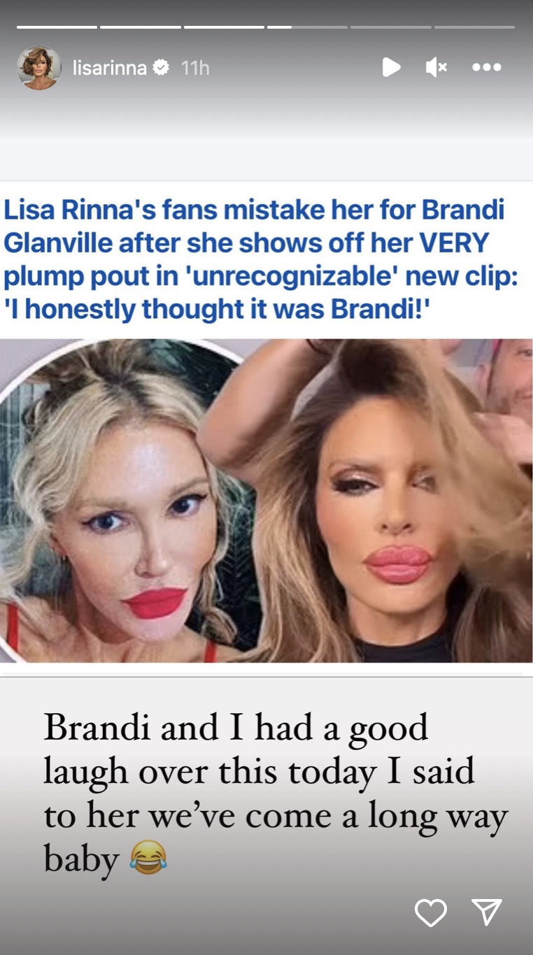 PHOTO: Fans Accuse Lisa Rinna of Looking Like Steven Tyler