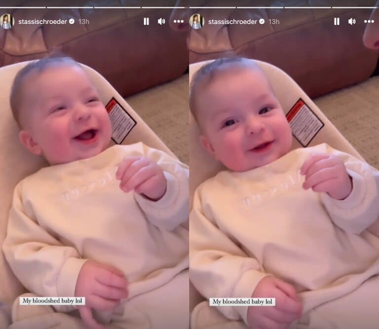 PHOTOS: Stassi Schroeder Shows Before & After Pics of Barbietox