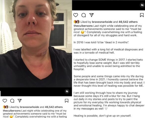 'RHOC' Briana Culberson Reflects on Near-Fatal "Medical Hell"