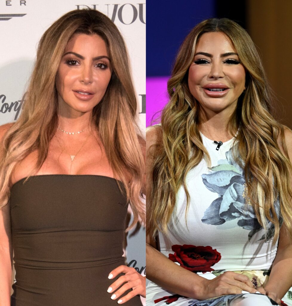 RHOM's Larsa Pippen Blames "Allergic Reaction" for Swollen Face After ...