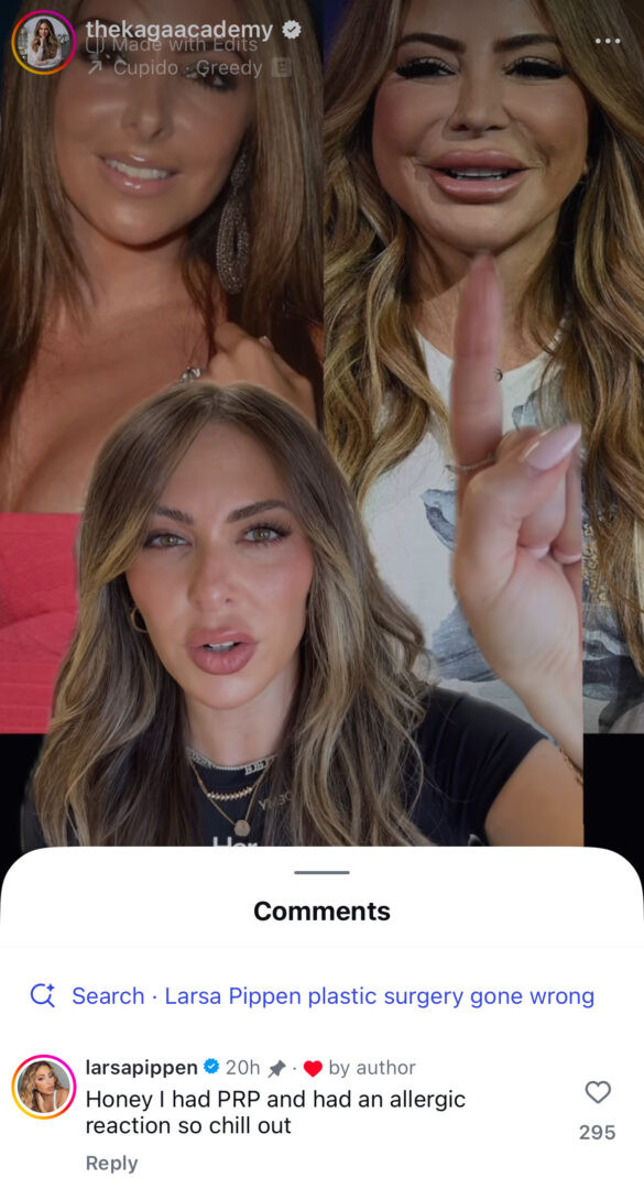 RHOM's Larsa Pippen Blames "Allergic Reaction" for Swollen Face After ...