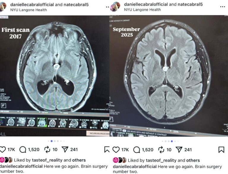 Danielle Cabral Reveals Husband Nate is Undergoing Brain Surgery as ...