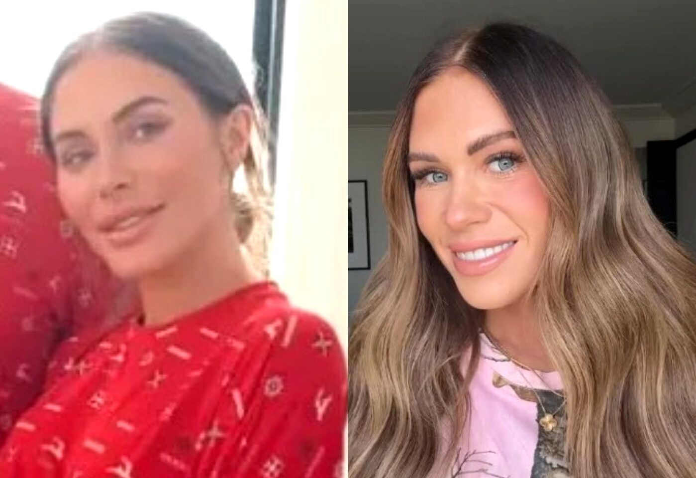 PHOTOS: SLOMW’s Jessi Ngatikaura Debuts Her New Face After Plastic Surgery